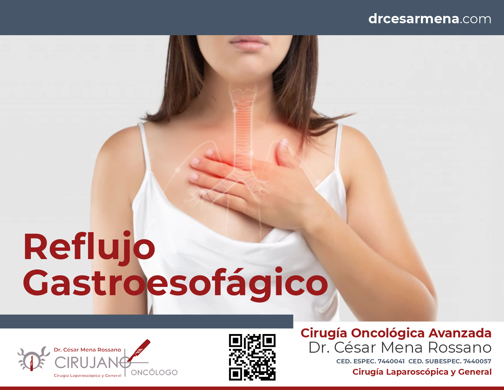 ¿qué Es El Reflujo Gastroesofágico Dr César Mena Rossanoemk 3427