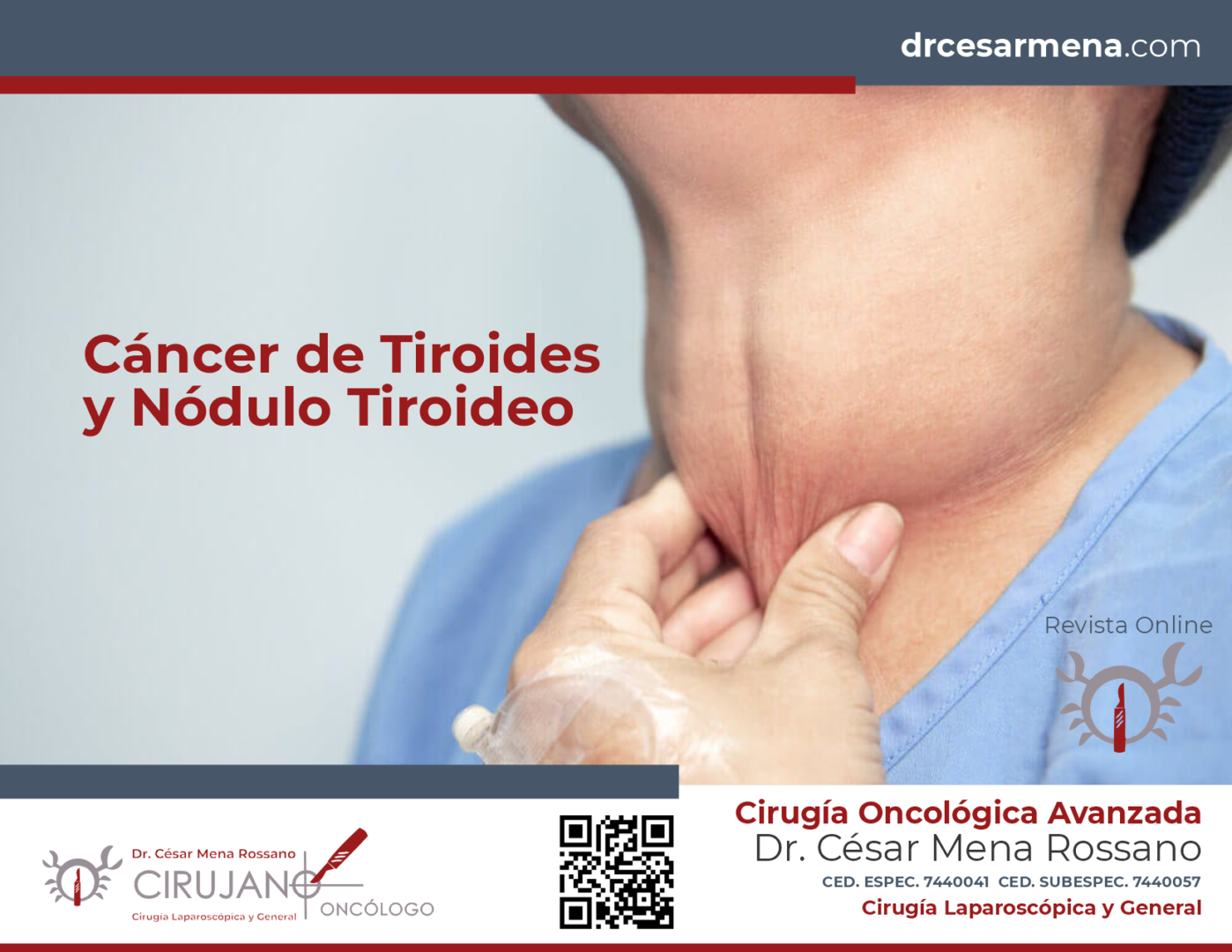 Cáncer de Tiroides y Nódulo Tiroideo – Dr. César Mena Rossano